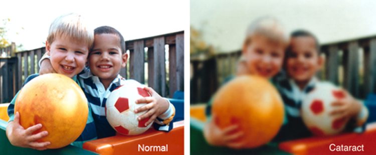 Welcome to the Discovery Eye Foundation Blog - Discovery Eye Foundation